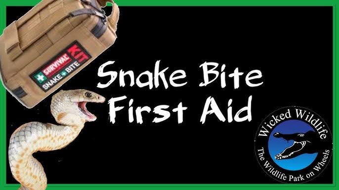How to Treat a Snake Bite: A Comprehensive Guide by St John WA - NEWS NEST