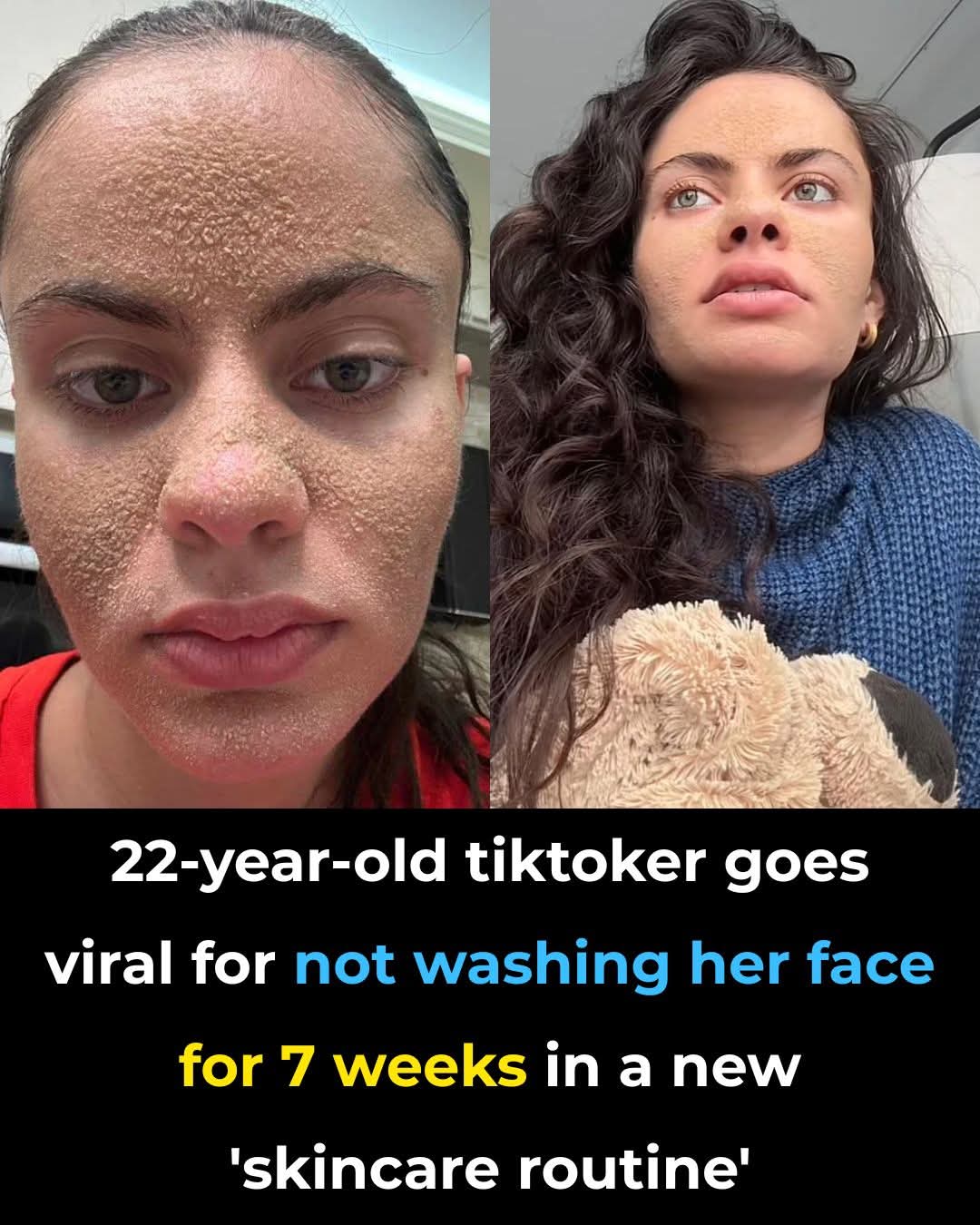 The TikTok Skincare Girl Who Refuses to Wash Her Face: Inside the ...